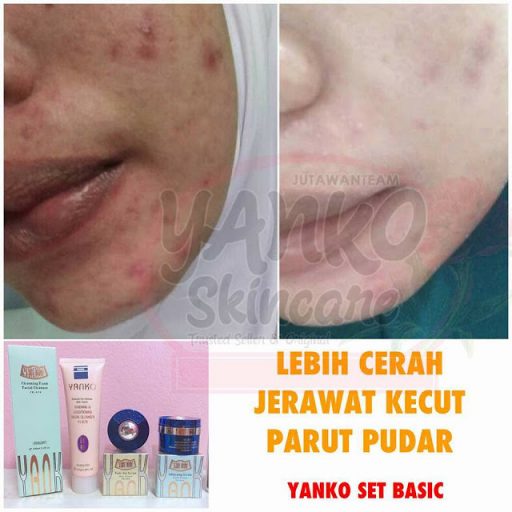 YANKO BASIC SET 3IN1 - Best Buy Beauty Plaza