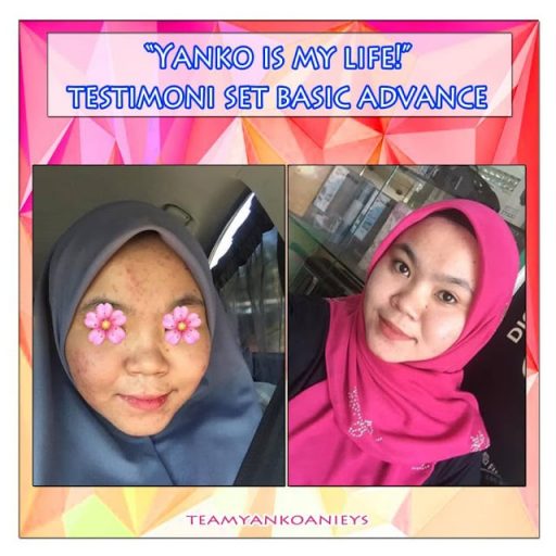 YANKO BASIC SET 3IN1 - Best Buy Beauty Plaza